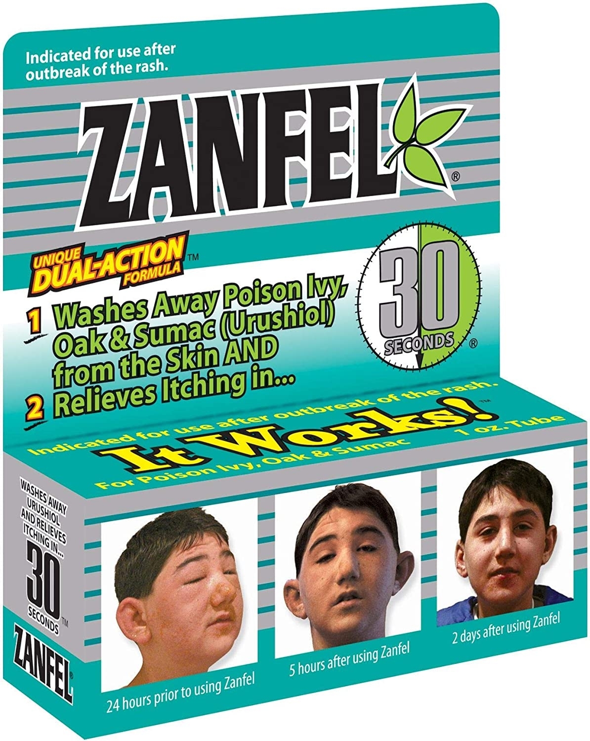 Buy Zanfel Poison Ivy Oak Sumac Itch Relief Wash 1oz. Tube Online ...